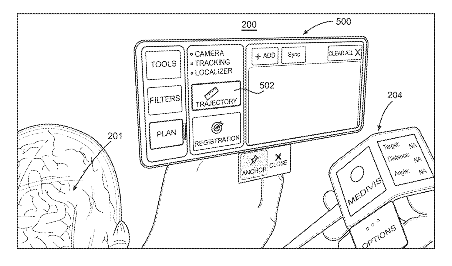 Medivis Surgical AR Patents: Augmented Reality in Surgery